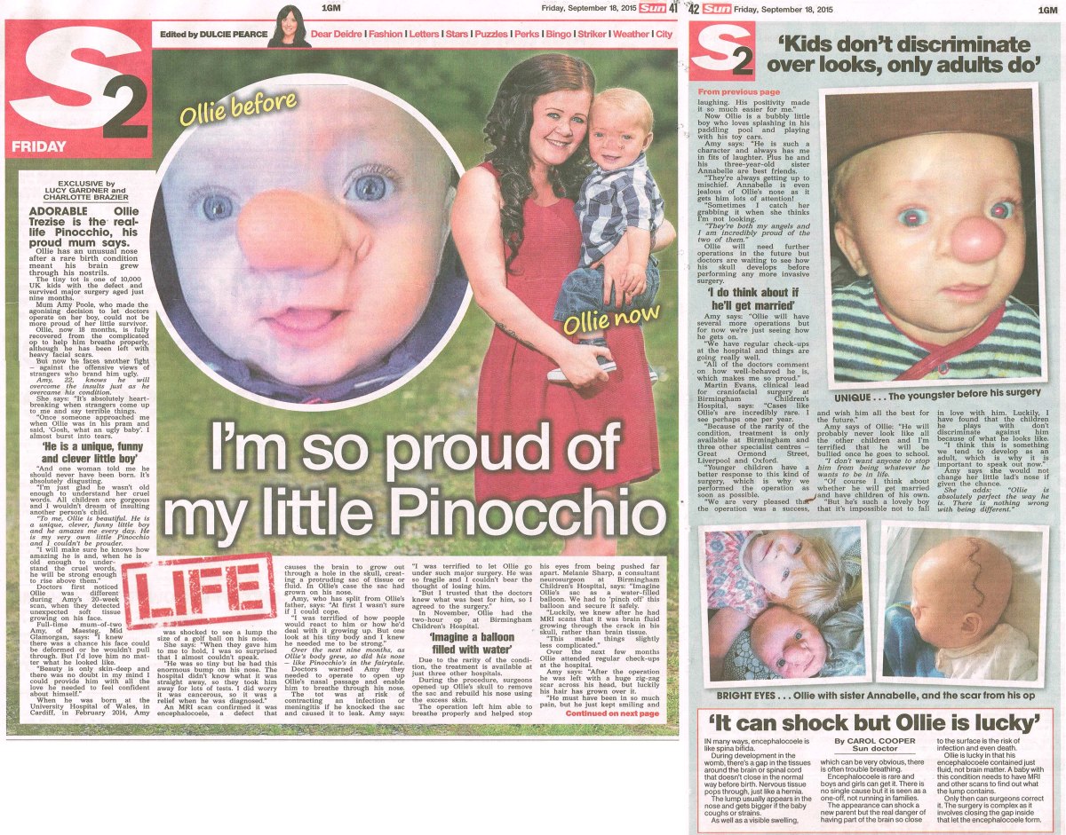 My son is the real life Pinocchio! – Charlotte Brazier